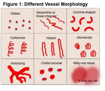 Practical Dermoscopy: Part 2 - Next Steps in Dermatology