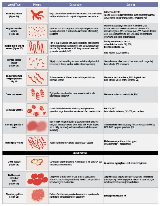 Practical Dermoscopy: Part 2 - Next Steps in Dermatology