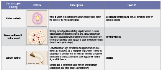 Practical Dermoscopy: Part 2 - Next Steps in Dermatology