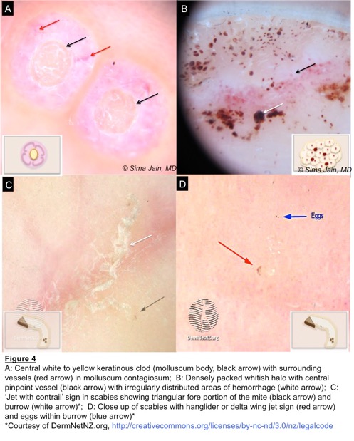 Practical Dermoscopy: Part 2 - Next Steps in Dermatology