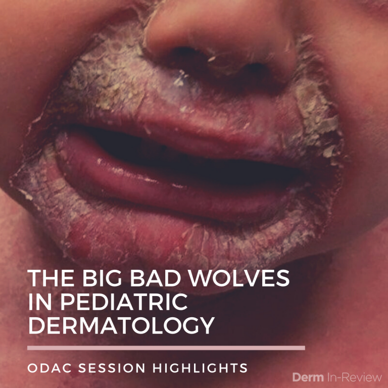 Mycoplasma-induced Rash and Mucositis Archives - Next Steps in Dermatology