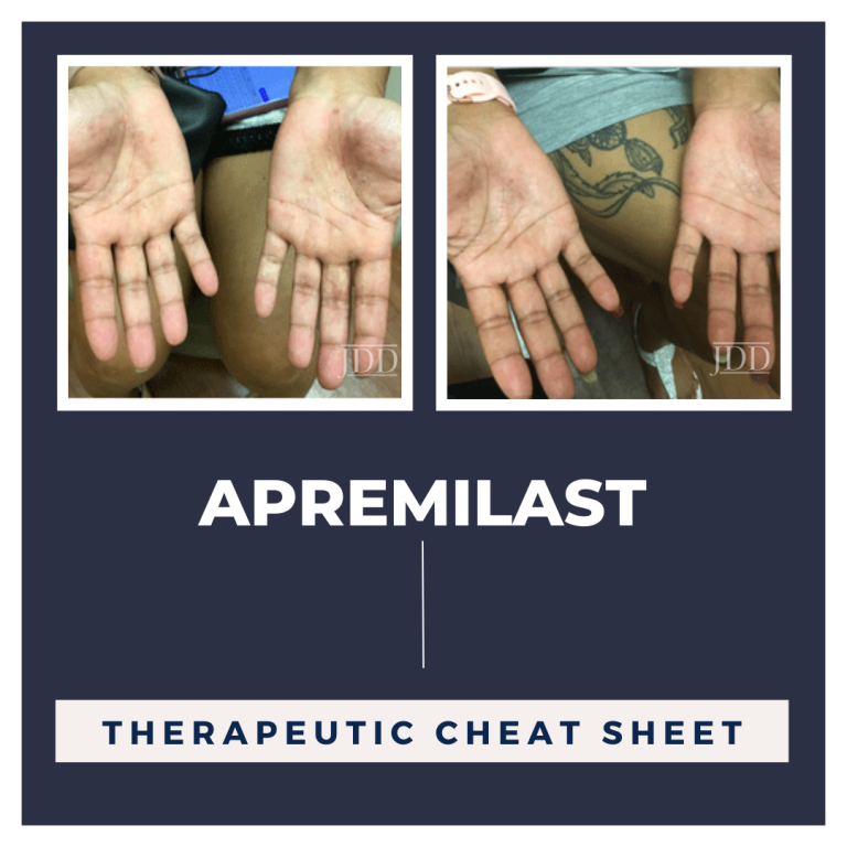 Apremilast Therapeutic Cheat Sheet - Next Steps in Dermatology