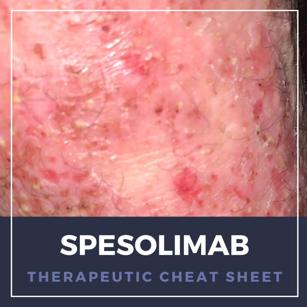 Spesolimab Therapeutic Cheat Sheet - Next Steps in Dermatology